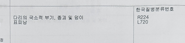 피부 양성종양적출수술 보상 청구