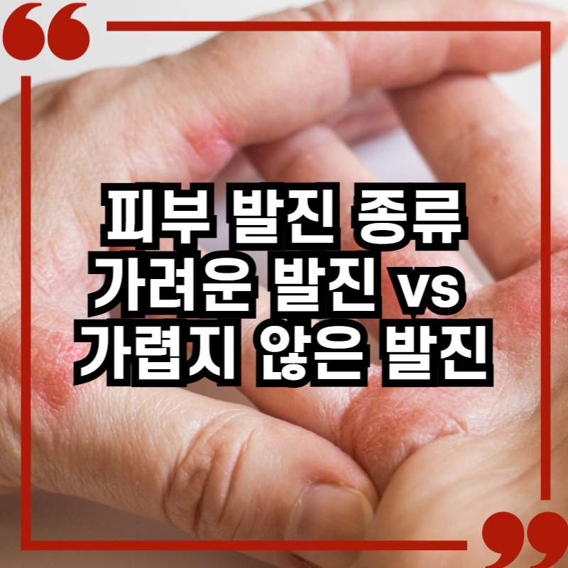 피부 발진 종류 가려운 발진 Vs 가렵지 않은 발진