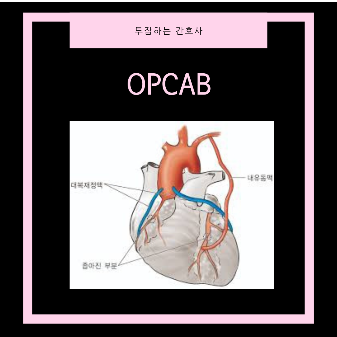 의학용어 cabg , 수술에 대하여 알아볼게요. ft, OPCAB :: 투잡하는 간호사