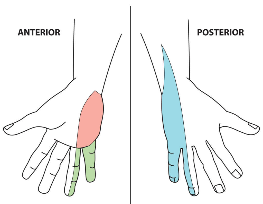 [투석실 이야기] 손이 저려요(2) : 자신경굴 증후군(ulnar entrapment syndrome), 팔꿉굴증후군 (주관 ...