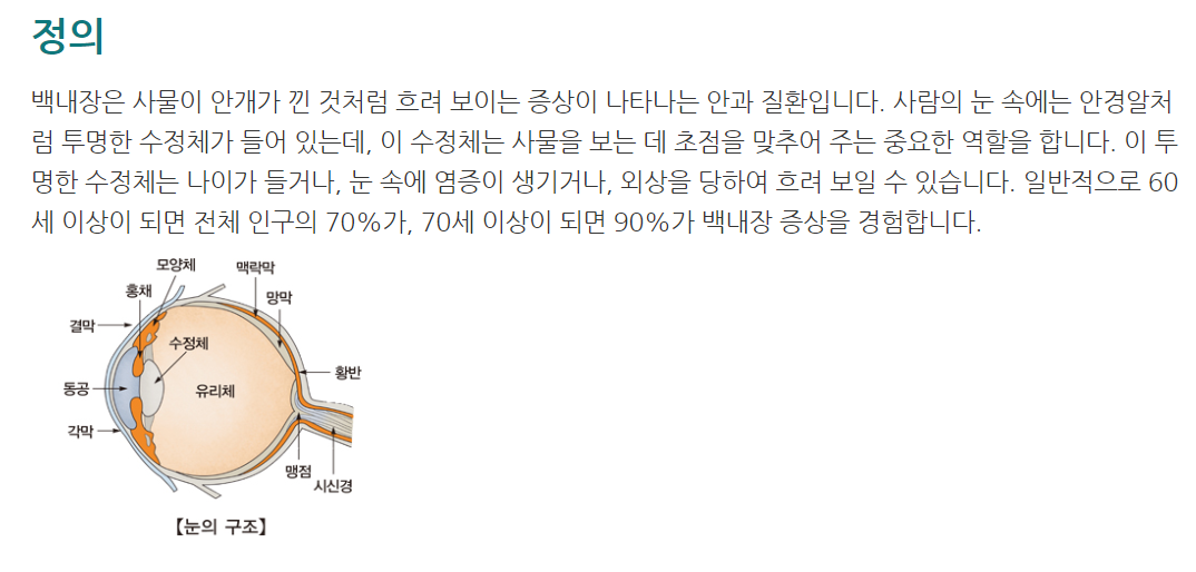 백내장 치료 그리고 예방방법 건강 쉼표