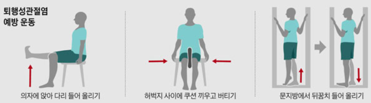 관절염 명의 배지훈 교수 프로필 관절염 증상 관절염 치료 서울인포스트