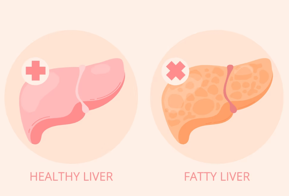 간에 좋은 영양제 UDCA 고르는법 효능 복용법