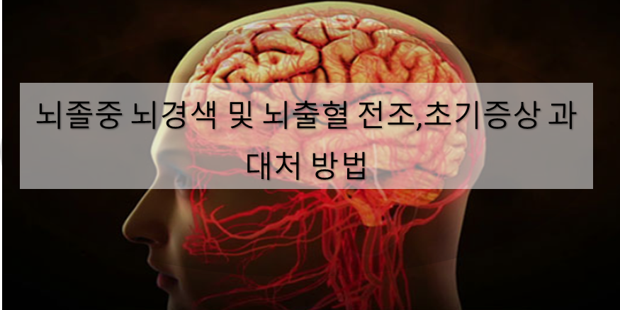 뇌졸중 뇌경색 및 뇌출혈 전조초기증상 과 대처 방법 호율안 소소한 이야기