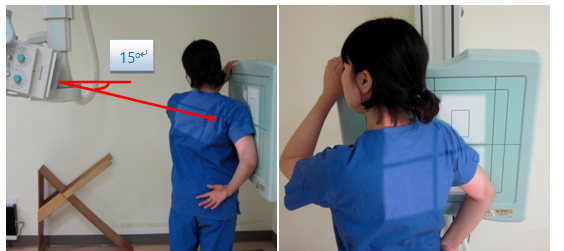 2) 호흡법 : 호흡을 정지하고 검사한다