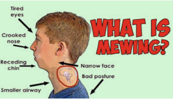뮤잉운동(mewing)을 아시나요?