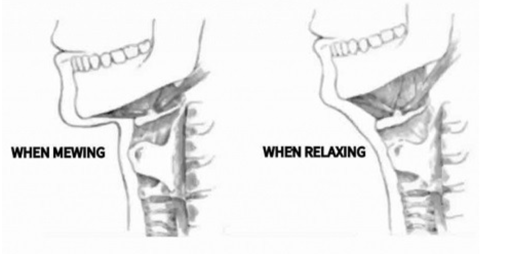 뮤잉운동(mewing)을 아시나요?