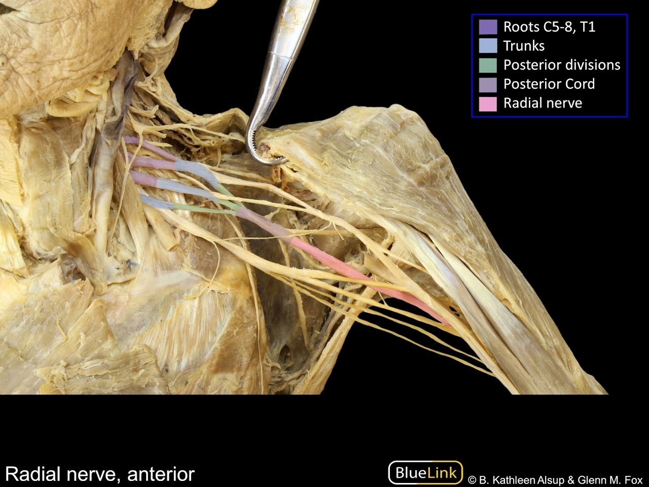 상완신경총(The Brachial Plexus)