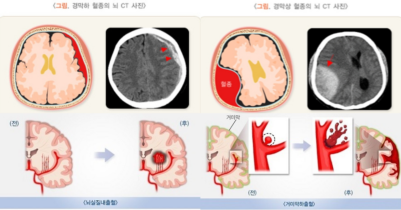 그러니까 하지 말라고 했잖아요