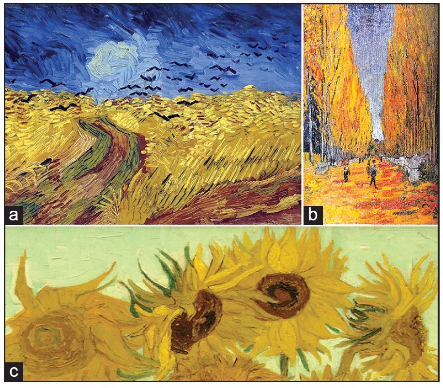 빈센트 반 고흐의 추정 질환과 시대적 배경