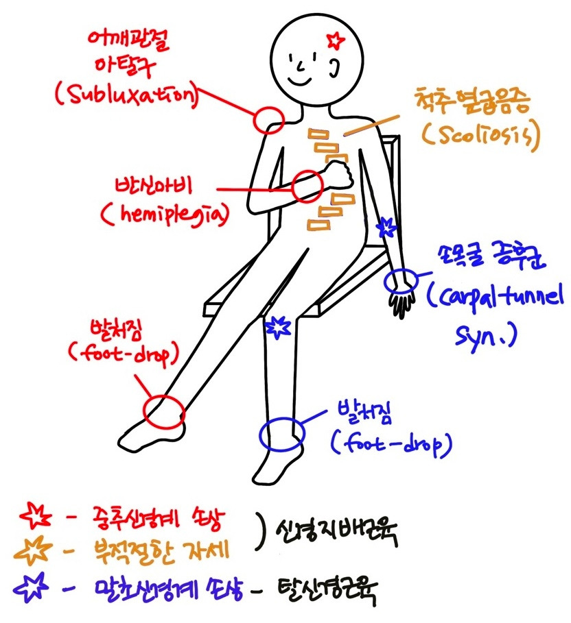 탈신경근육이 뭐예요