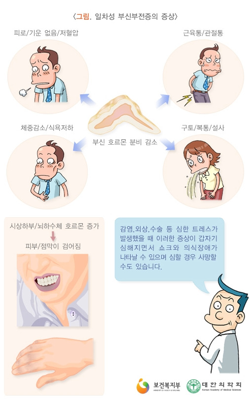 피로 관절통 체중감소부신기능저하증 증상