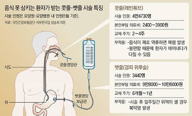 단독 뱃줄 놔둔채 콧줄 급식 4만명 고통
