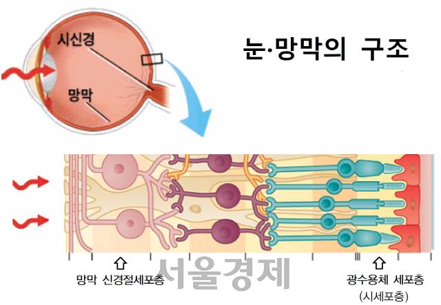 녹내장 심해질수록 시세포 기능도 떨어진다
