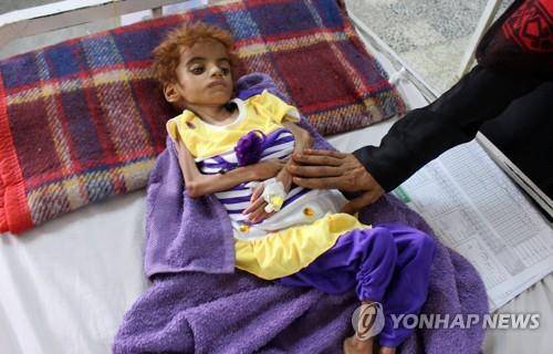 유엔 전세계 기아 인구 3년 연속 증가北주민 43 영양부족종합