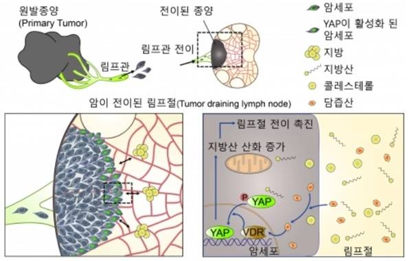 암세포 림프절 전이 시 지방산 이용한다