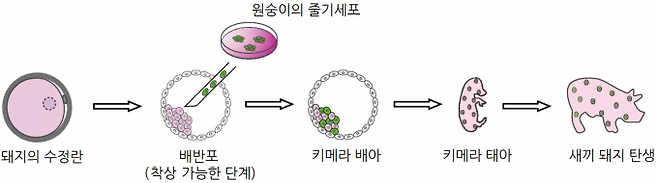 이정아의 미래병원 바이오 인공장기 시대가 온다