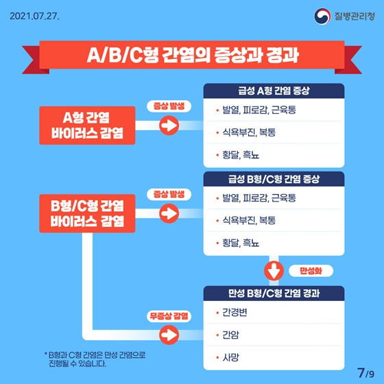 세계 간염의 날a·b·c형 간염 증상과 예방법은