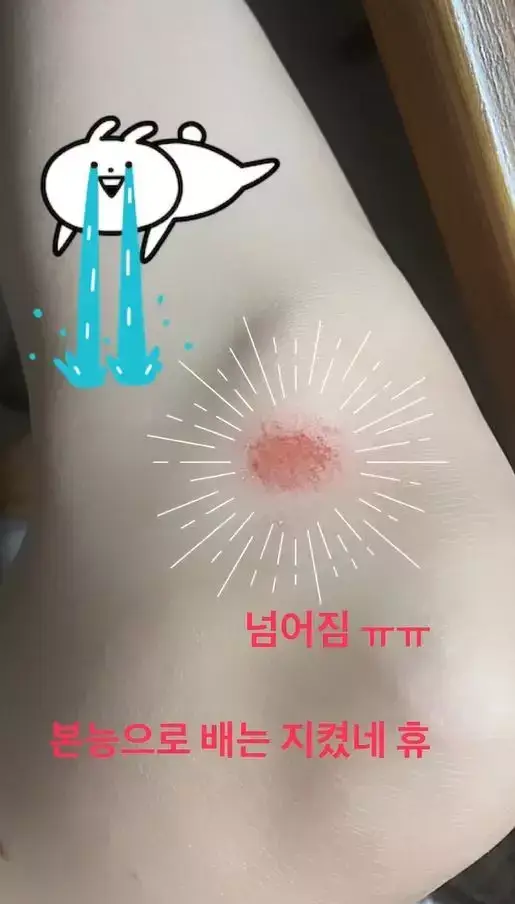 출산일이 코앞인데 아찔한 사고 낸 여자 연예인 키노라이츠
