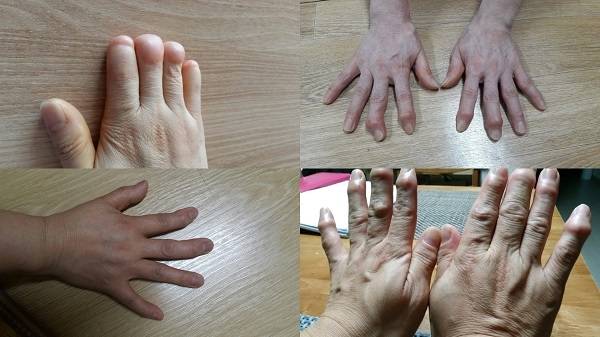 노동자 손가락 12개 잘리고 나서야 조치 나선 제주교육청