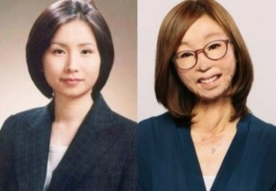 음주운전 사고로 전신화상지선아 사랑해의 그녀 이대 교수됐다