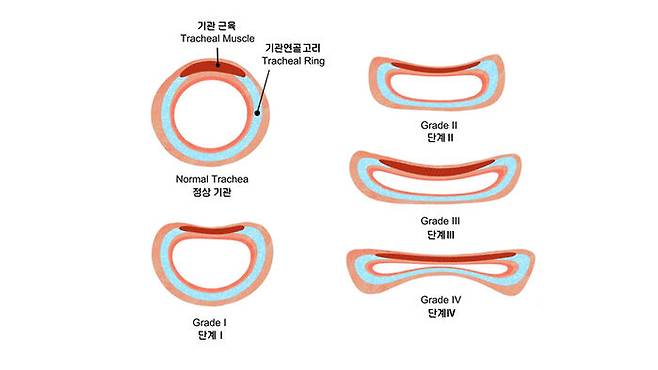 스프 반려견이 갑자기 컹컹 거위 소리를 낸다면
