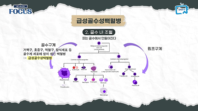 한눈에 이해하는 급성골수성백혈병 서울대학교병원