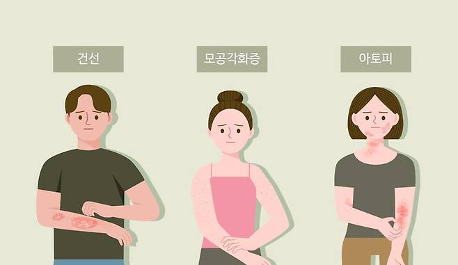 사각지대에 놓인 청소년 아토피‘가려움증 최신 치료법은