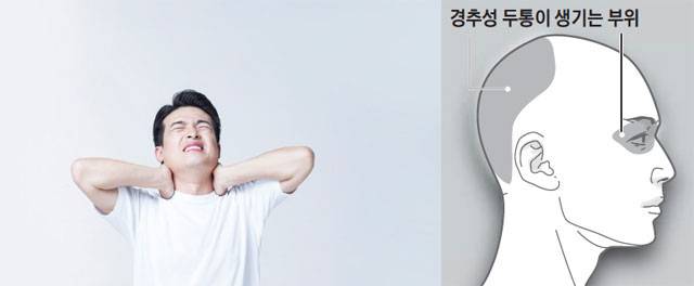 눈까지 아픈 두통 머리 아닌 ‘이곳 다친 게 원인일 수도