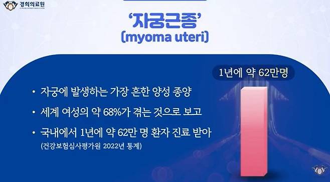 늦은 결혼·초산에 자궁근종 증가젊어도 방심은 금물