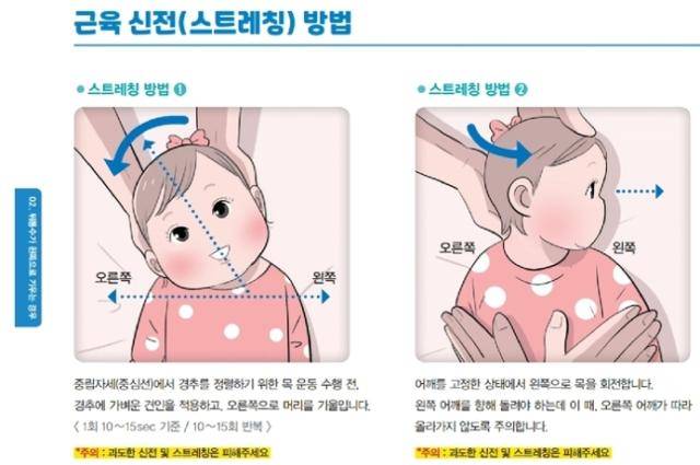 기울어진 아기 목사경 측경 오인해 집에서 잘못된 재활 운동 많아