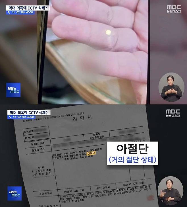 문 닫다가 유치원서 손가락 잘린 4살‥교사 아동학대 혐의 송치