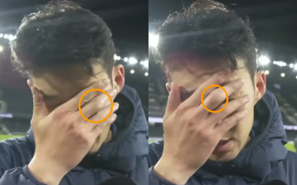 고통스럽다”며 얼굴 감싼 손흥민손가락 상태 그대로 드러났다