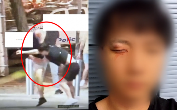 경찰서 코앞에서호주 한인 백인 남성들에 인종차별 폭행당해