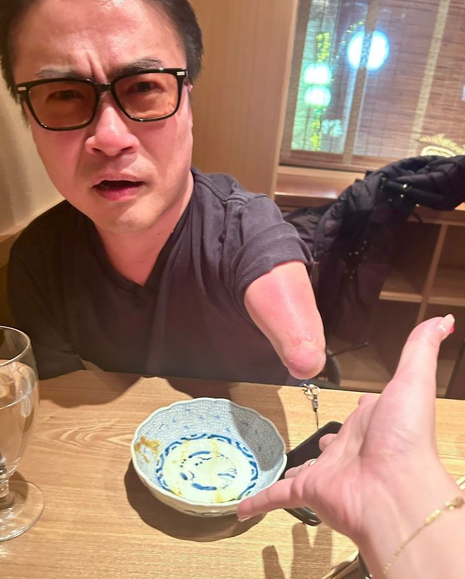 ‘오체불만족 오토타케 불륜파문 후 근황日국회의원 재도전