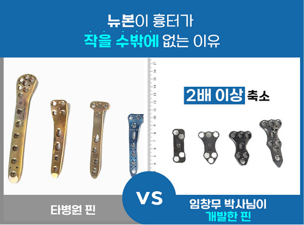 휜다리수술 잘하는 병원 고르는 법 정형외과의 미용적수술 사지연장술 휜다리수술