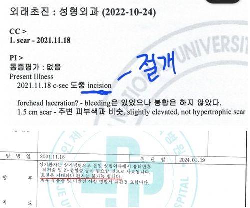 제왕절개로 낳은 딸 얼굴에 칼자국병원 대응에 부모 분통