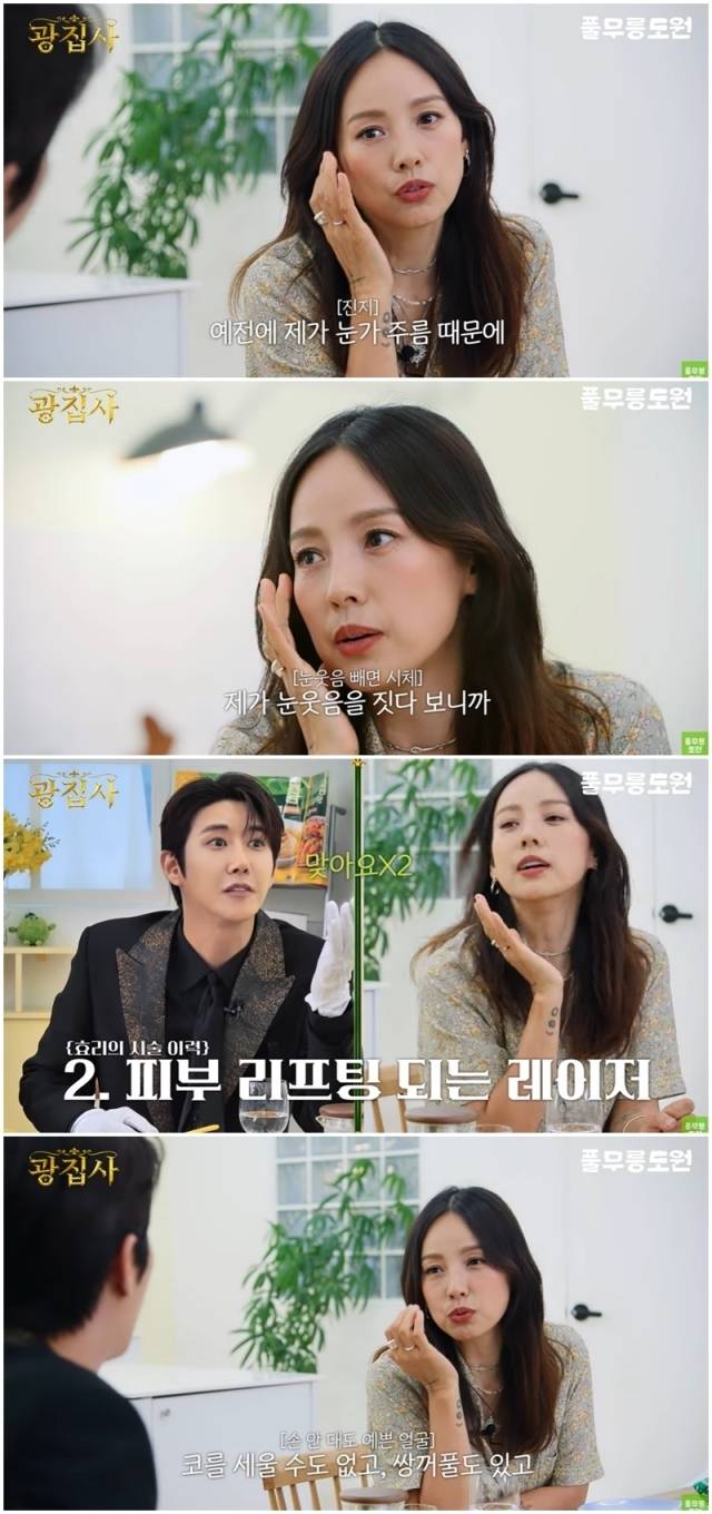 쟁반노래방때 보톡스 시술” 이효리 눈웃음 부작용에 포기레이저시술도 안 맞아 솔직 고백 Md픽 종합