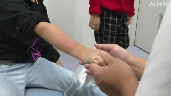 감염시 유산위험” 4년만에 유행하는 ‘사과병 뭐길래옆나라는 비상 걸렸다