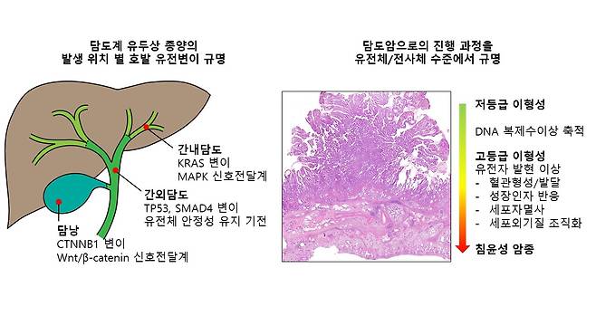 5년 10명 중 7명 사망” 치명적 ‘담도암유전자검사로 조기진단길 열린다