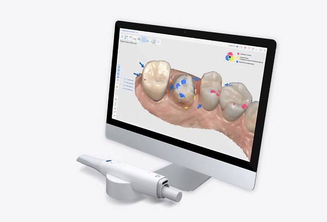 MBK·UCK, 메디트 2년째 적자에도 배당 900억 받아갔다