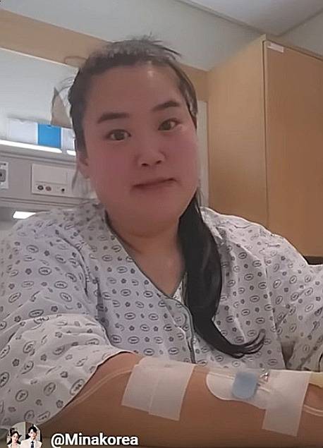 🔥150kg에서 99kg?! 미나 시누이 박수지, 다이어트 성공 비결 대공개 | 트렌드로