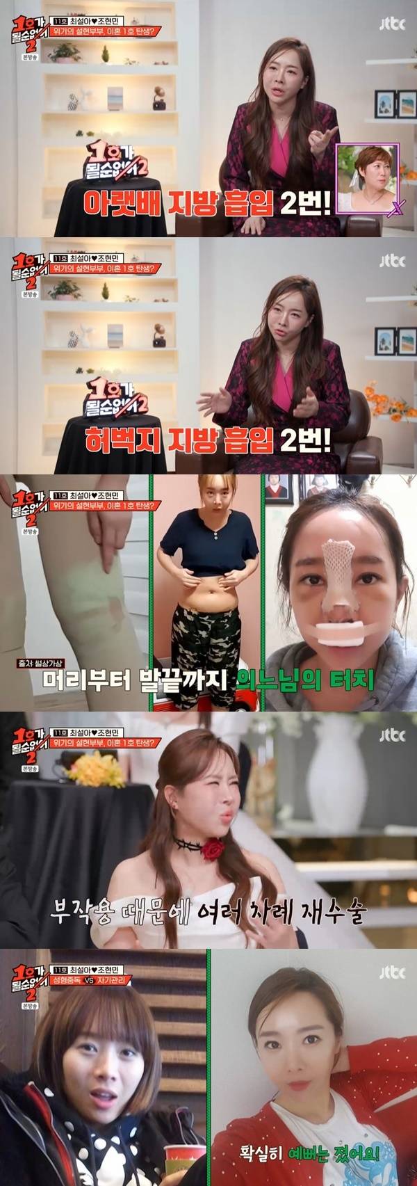 ‘1호가’ 첫방부터 이혼위기+성형전후 공개 “코 3번+눈 2번+지방흡입 4번”[어제TV]