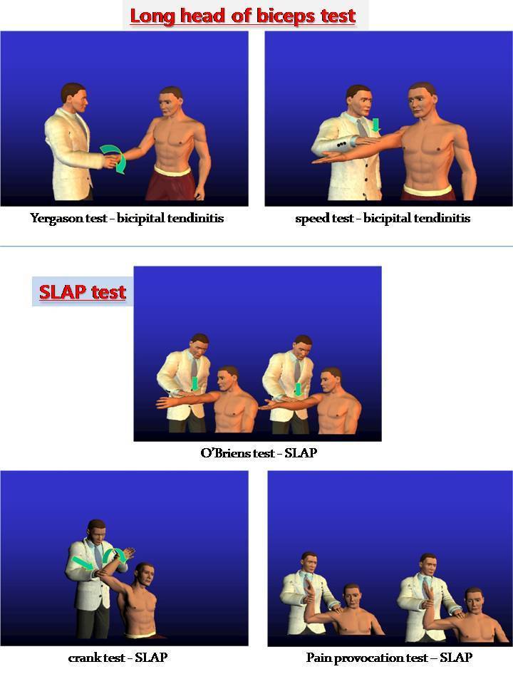 Speeds Test Shoulder