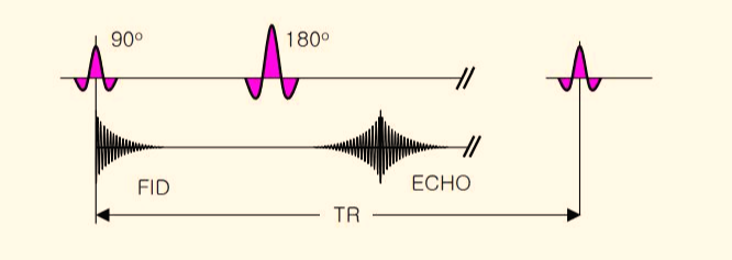 MRI Parameters. 부가인자 TR(Repetition time)