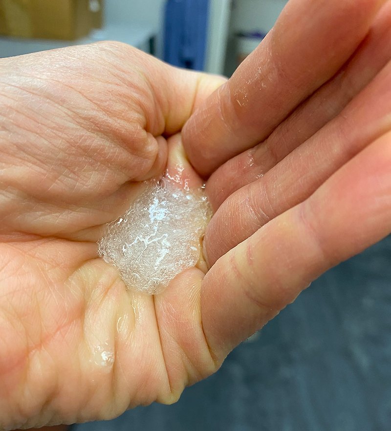 [영읽쓰]This electric ‘slime’ might help injuries heal faster