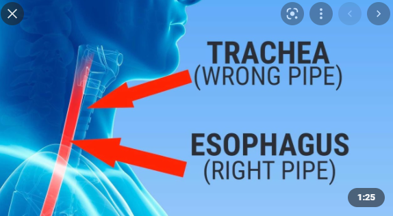 사레들다-go down the wrong pipe. get something caught in one's windpipe ...