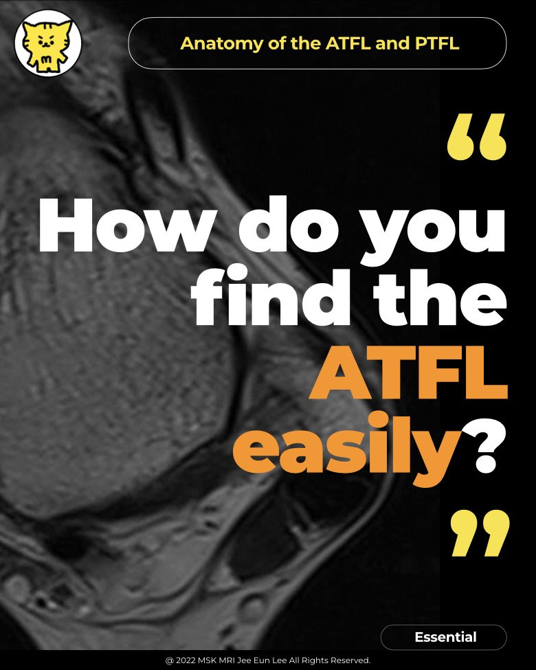 [Essential Path] Anatomy_ MRI Evaluation of ATFL and PTFL Key Features