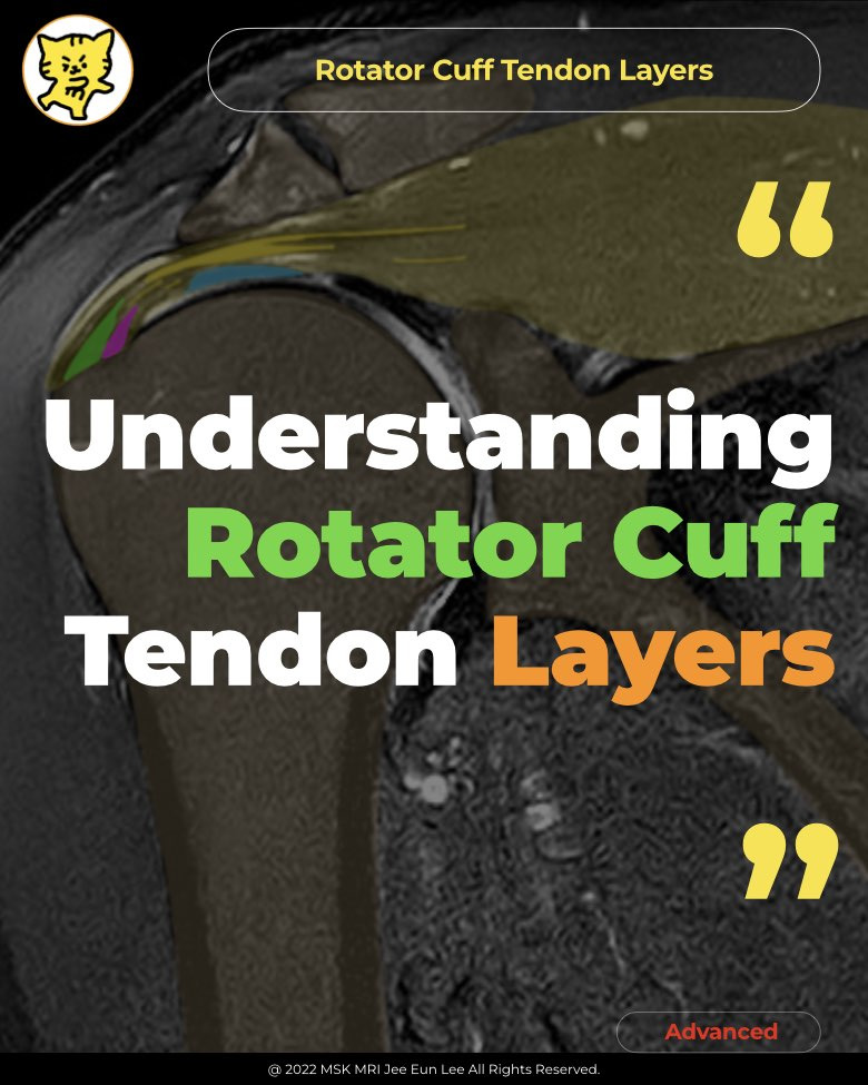 [Advanced] Understanding Rotator Cuff Tendon Layers: Structure and MRI ...