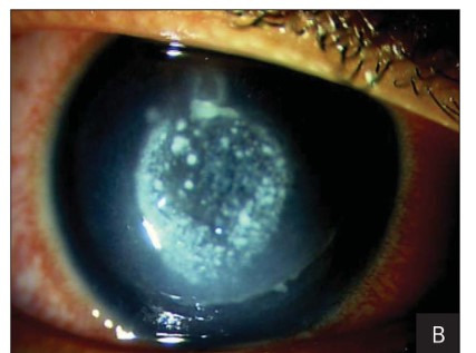 Etiology, pathophysiology, diagnostic delay, characteristics and ...